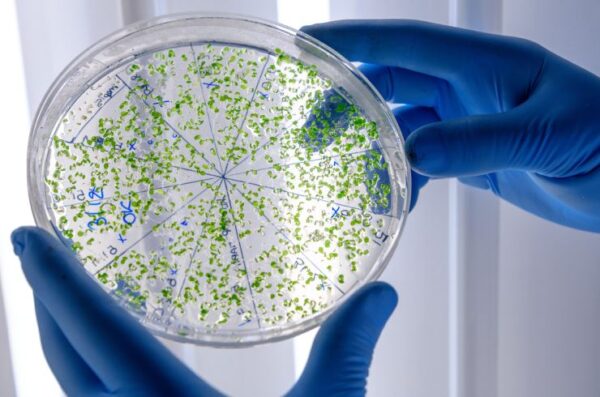 Microbiology - Genpath Labs